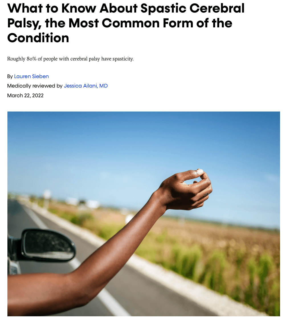 Spastic Cerebral Palsy